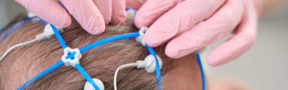 La rTMS : pour qui, déroulement des séances, contre-indications - Carenity